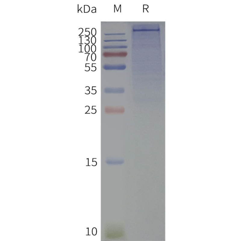 SCN2A: Molecular Mechanisms, NaV1.2 Function, and Precision Therapeutic ...